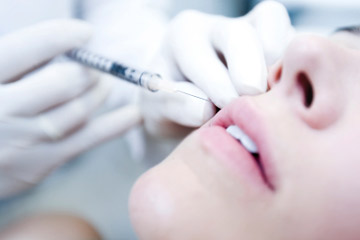 How Dermal Fillers Work | HowStuffWorks