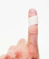 20 Home Remedies for Cuts | HowStuffWorks