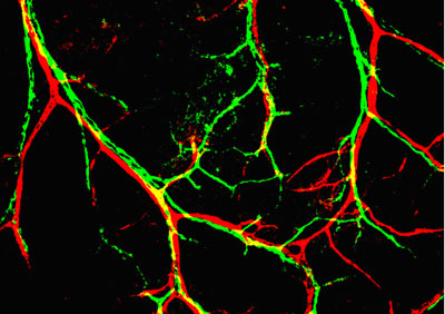 How Nerves Work | HowStuffWorks