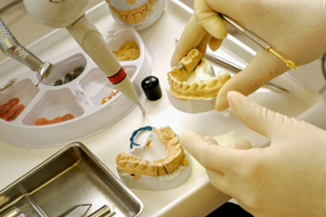 How are dental partials and bridges different? | HowStuffWorks